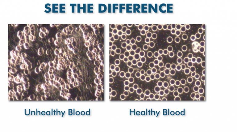 Live Blood Analysis - Lasting Health and Slimming